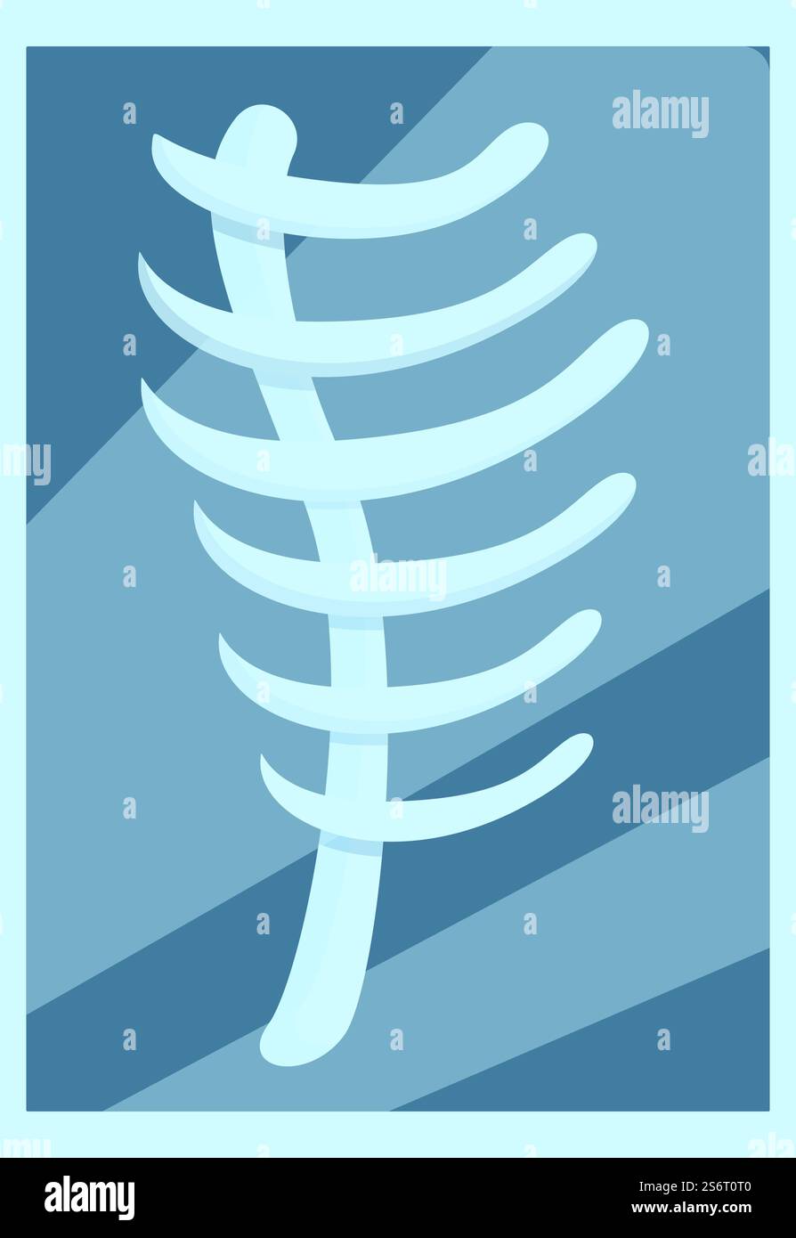 Xray chest scan icon cartoon vector. Clinic test. Medical ray. Xray ...