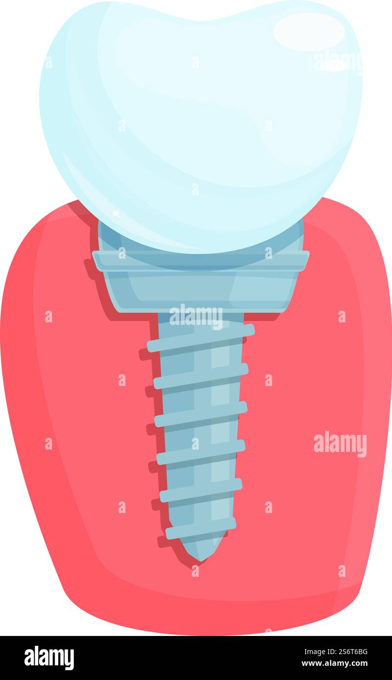 Procedure tooth implant icon cartoon vector. Dental crown. Oral denture ...