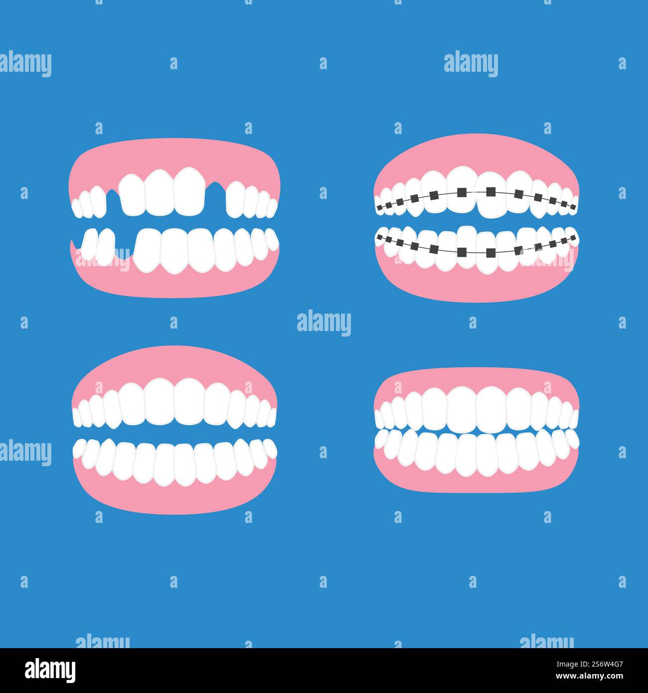 Denture icon vector flat design Stock Vector Image & Art - Alamy