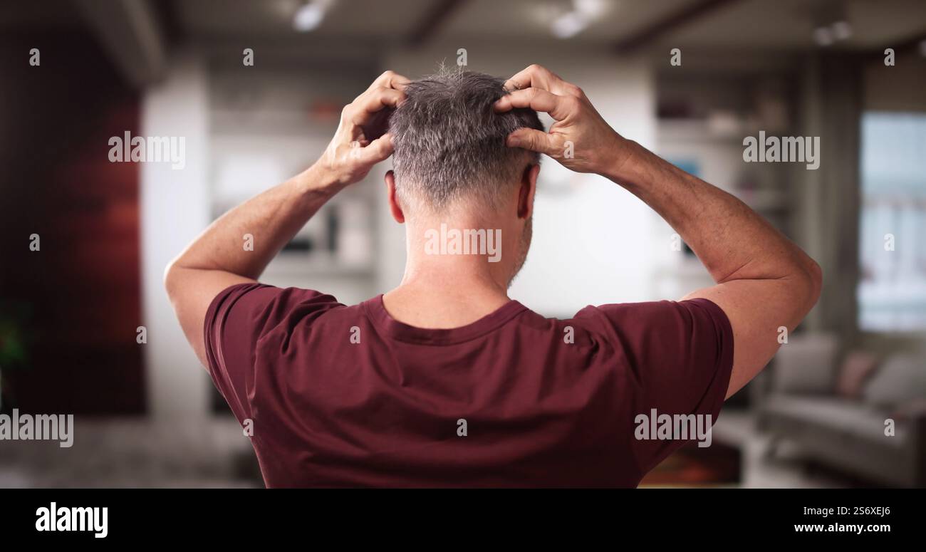 Itching Dry Head Scalp And Long Hair With Dandruff Stock Photo - Alamy