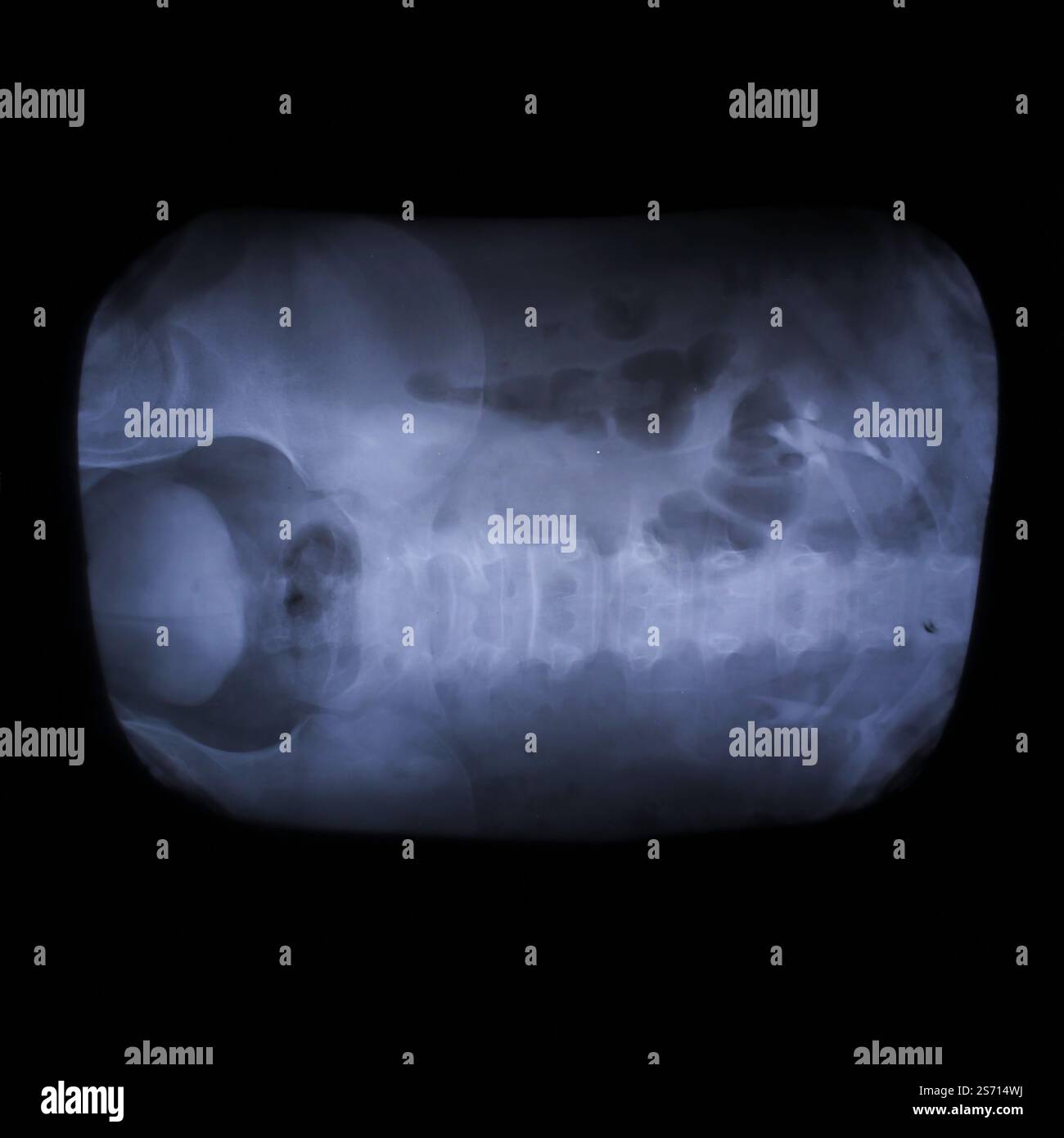 A detailed Medical Xray Image showcasing the organs and structures of ...