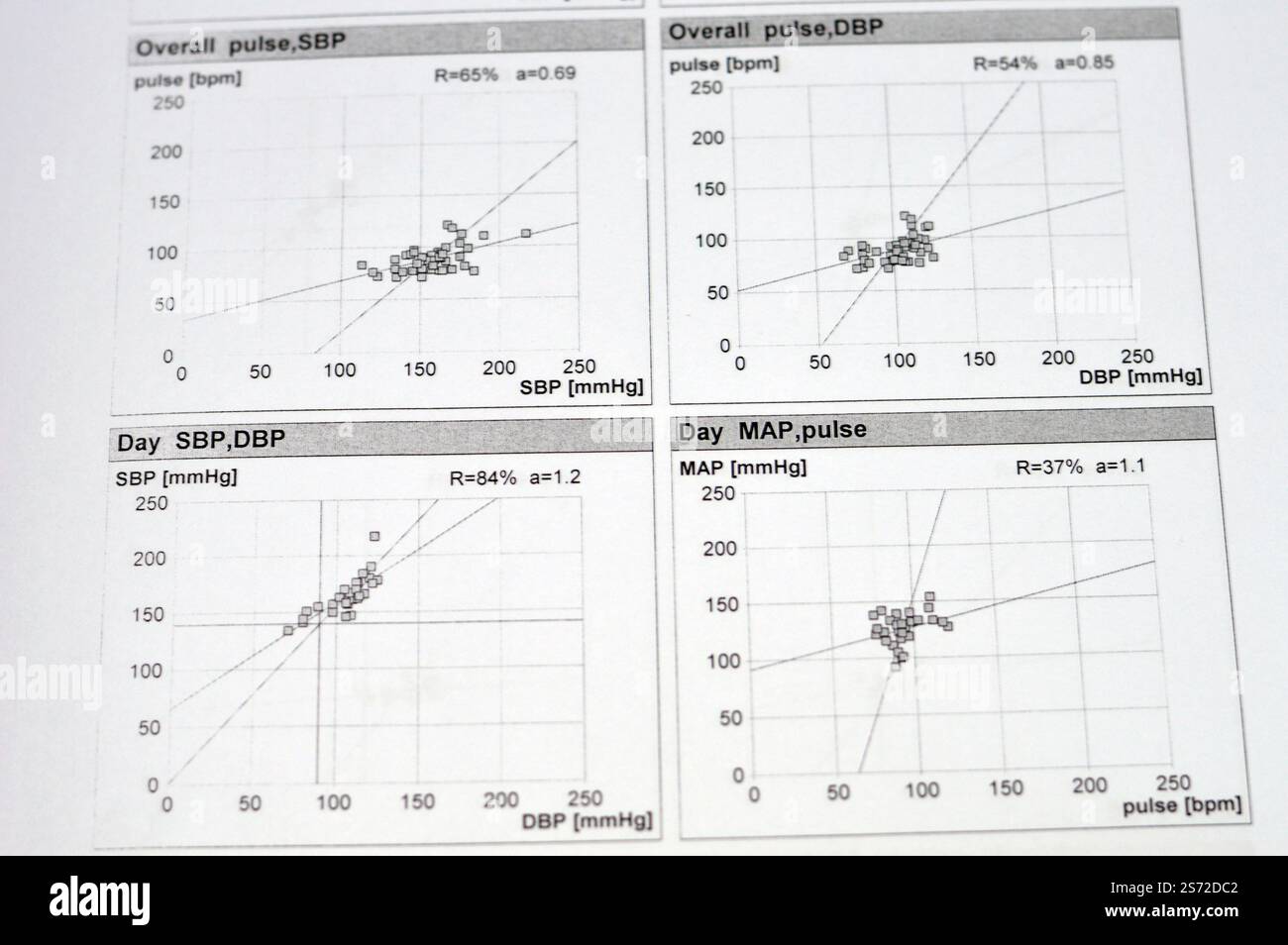 graphs from a 24 hours ambulatory blood pressure monitoring revealed ...