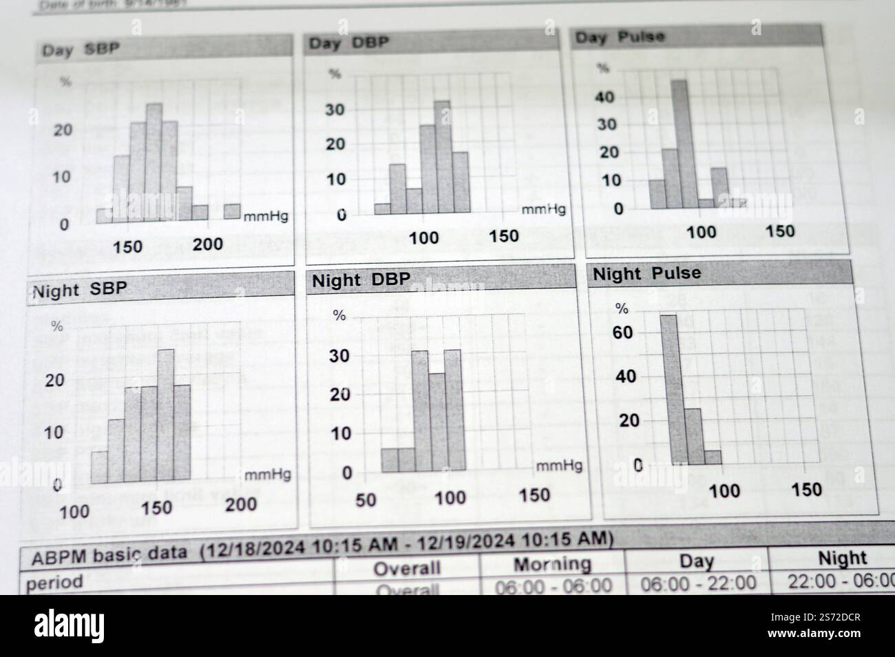 graphs from a 24 hours ambulatory blood pressure monitoring revealed ...