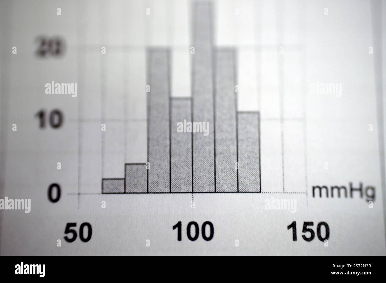 A graph from a 24 hours ambulatory blood pressure monitoring revealed ...
