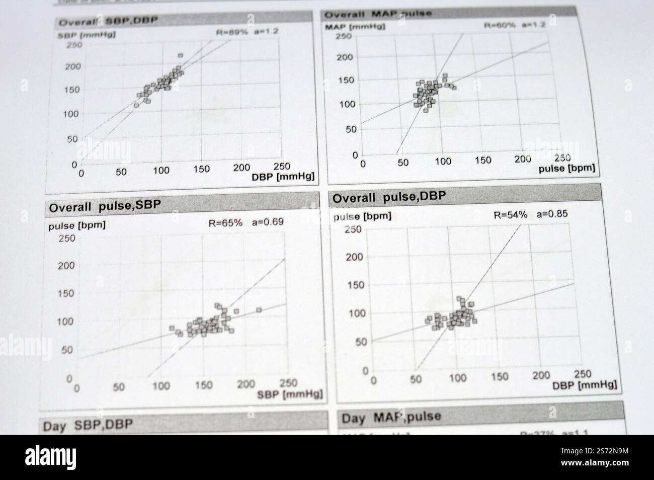 graphs from a 24 hours ambulatory blood pressure monitoring revealed ...