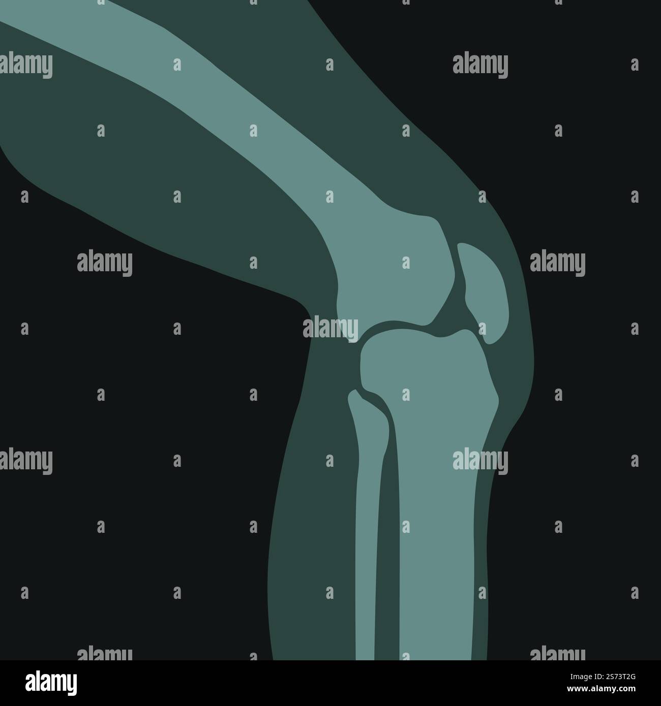 Roentgen scan of knee joint, x ray with detailed bone of the leg ...
