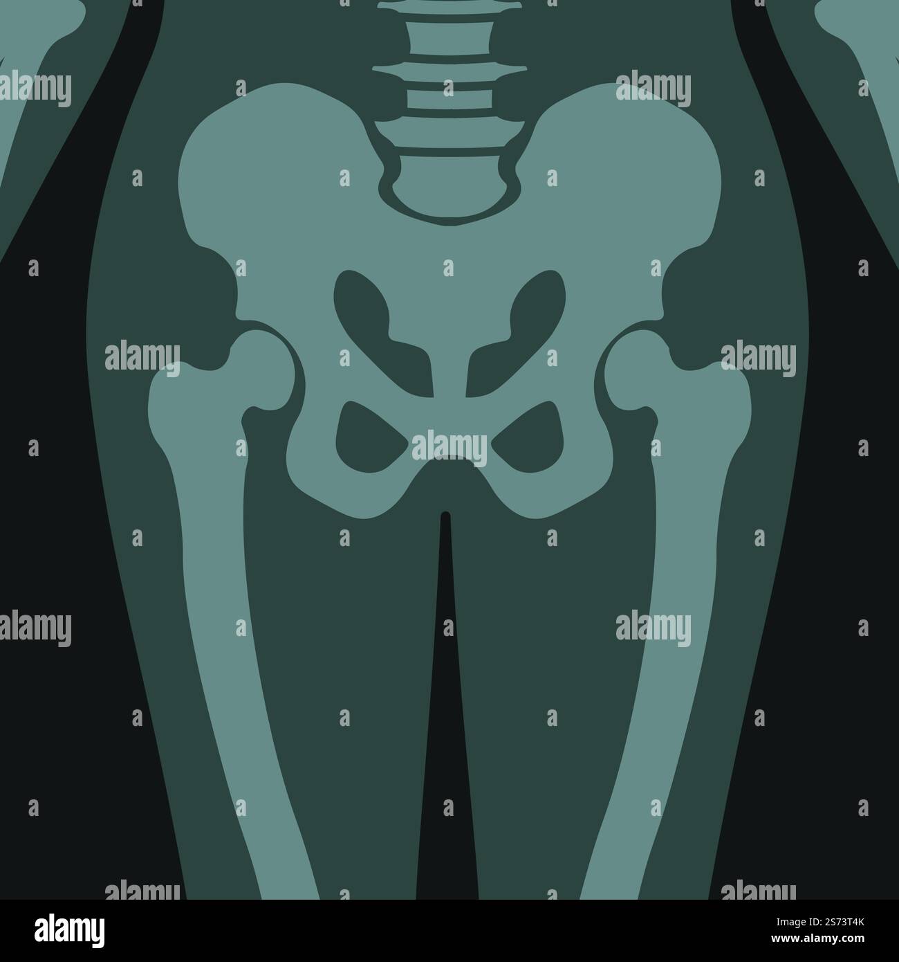 Pelvis x ray, healthcare in clinics or hospital, diagnostics and ...