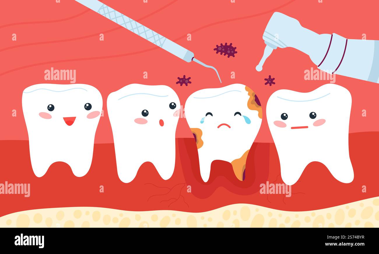 Dentist teeth treatment. Clean tooth on dental clinic, comic fun molar ...