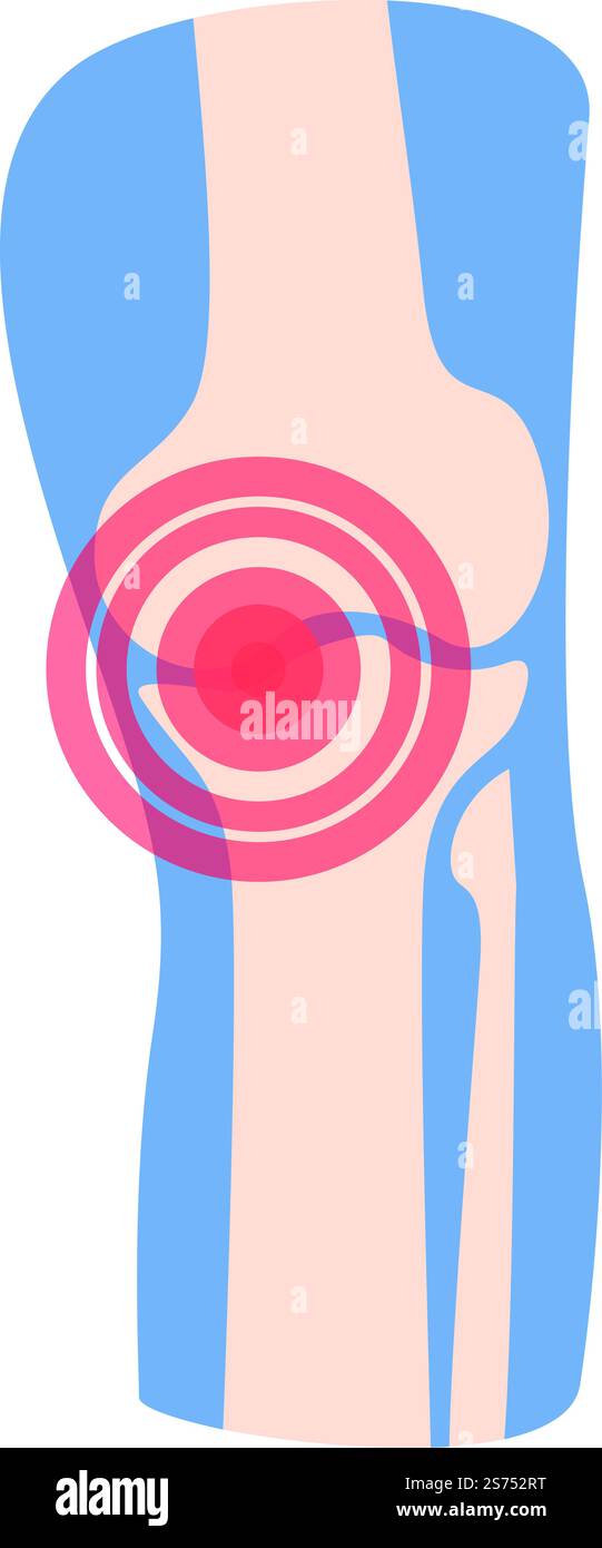 Patient leg icon cartoon vector. Arthritis joint. Pain treatment ...