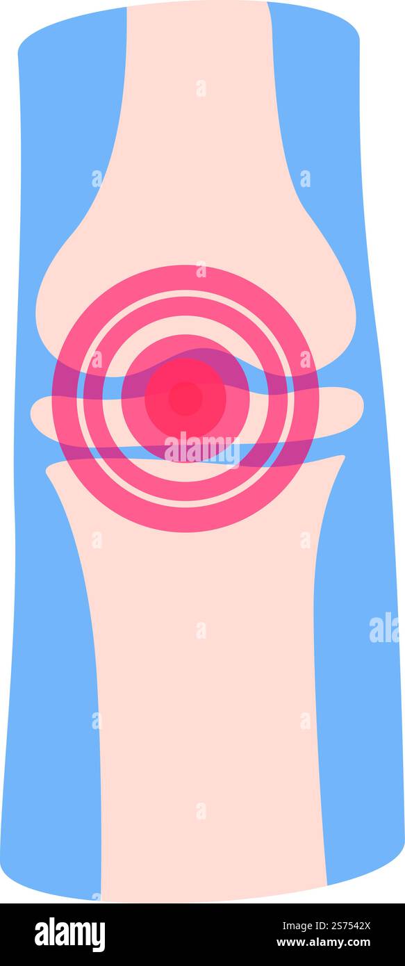 Knee pain icon cartoon vector. Patient clinic. Hospital disease. Knee ...