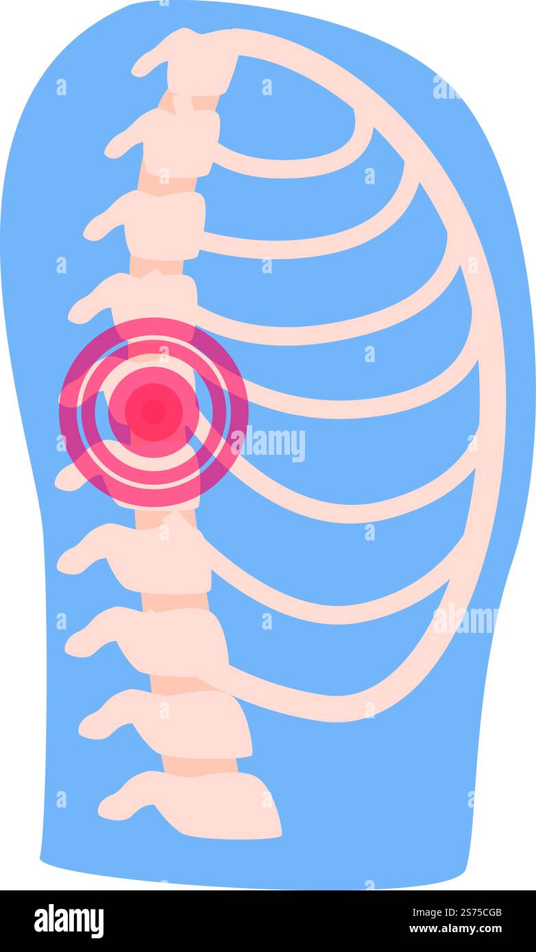 Patient spine pain icon cartoon vector. Arthritis joint. Medical ...