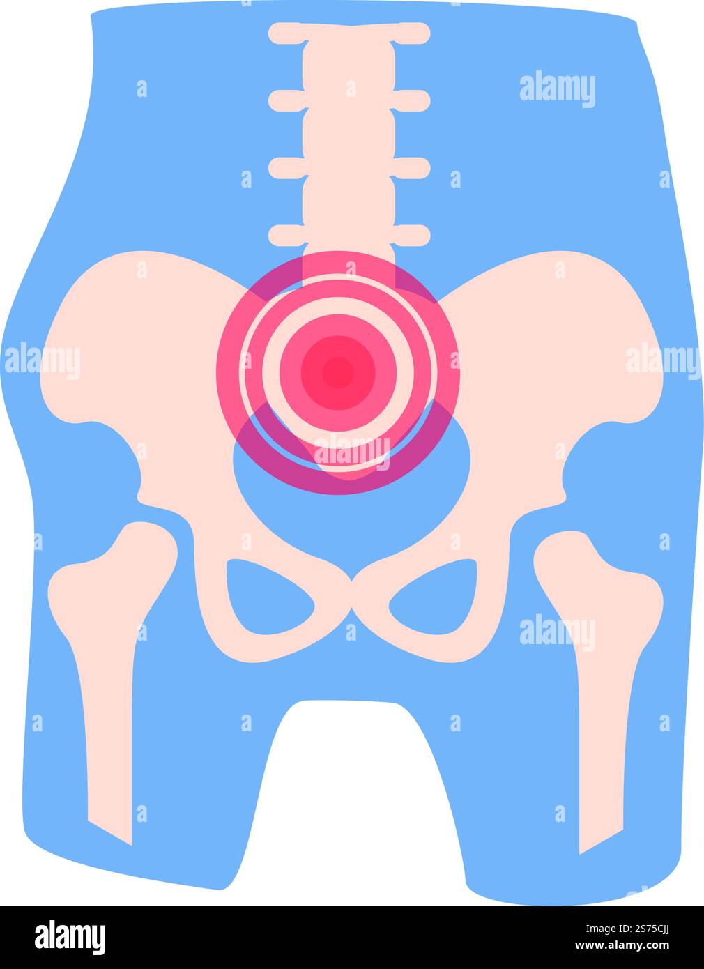 Body disease icon cartoon vector. Arthritis joint. Medical treatment ...