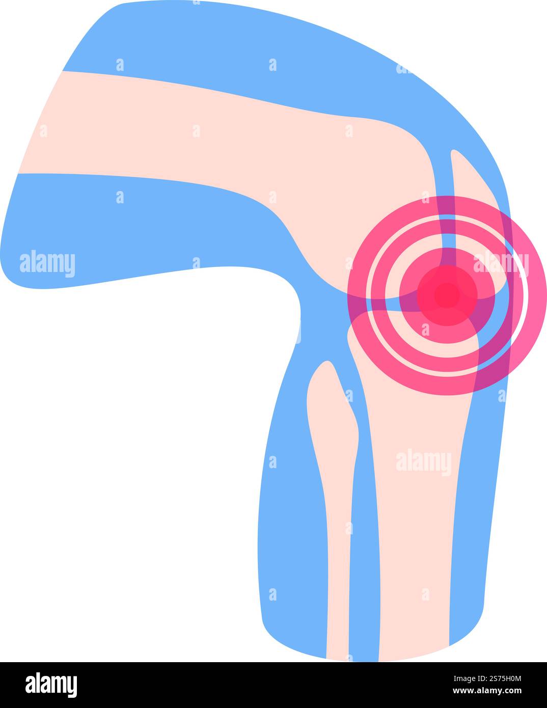 Knee pain icon cartoon vector. Arthritis joint. Treatment articulation ...