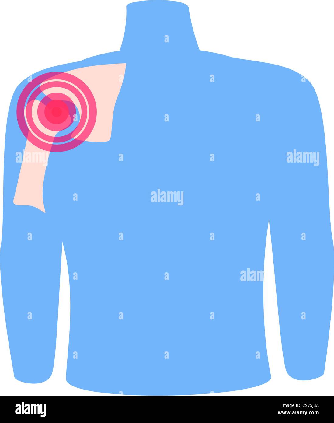 Shoulder arthritis icon cartoon vector. Joint pain. Rheumatoid doctor ...