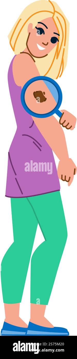skin cancer vector. melanoma patient, medicine doctor, health woman ...