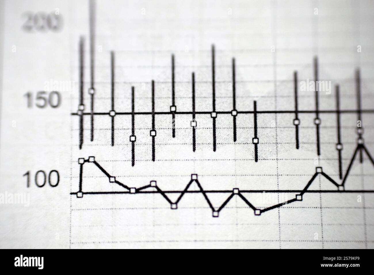 A graph from a 24 hours ambulatory blood pressure monitoring revealed ...