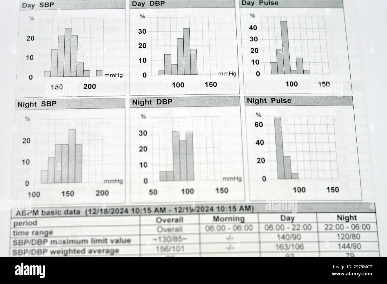 graphs from a 24 hours ambulatory blood pressure monitoring revealed ...