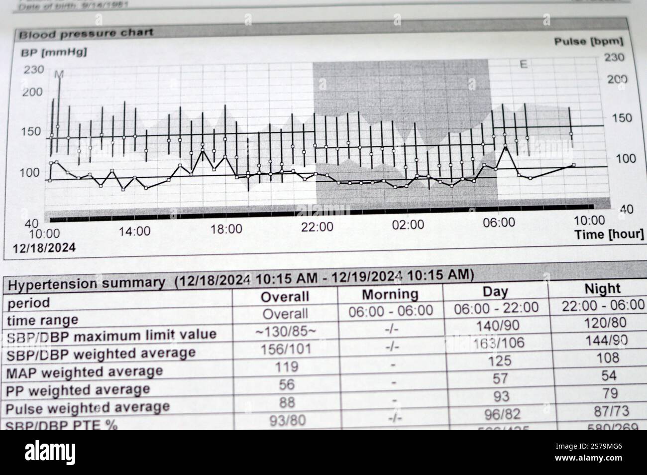 graphs from a 24 hours ambulatory blood pressure monitoring revealed ...