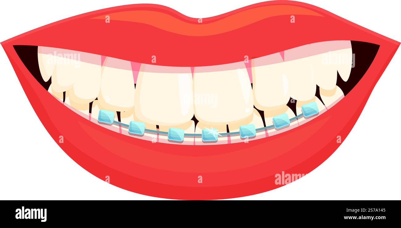 Woman lips smile icon cartoon vector. Tooth gem. Dental care. Woman ...