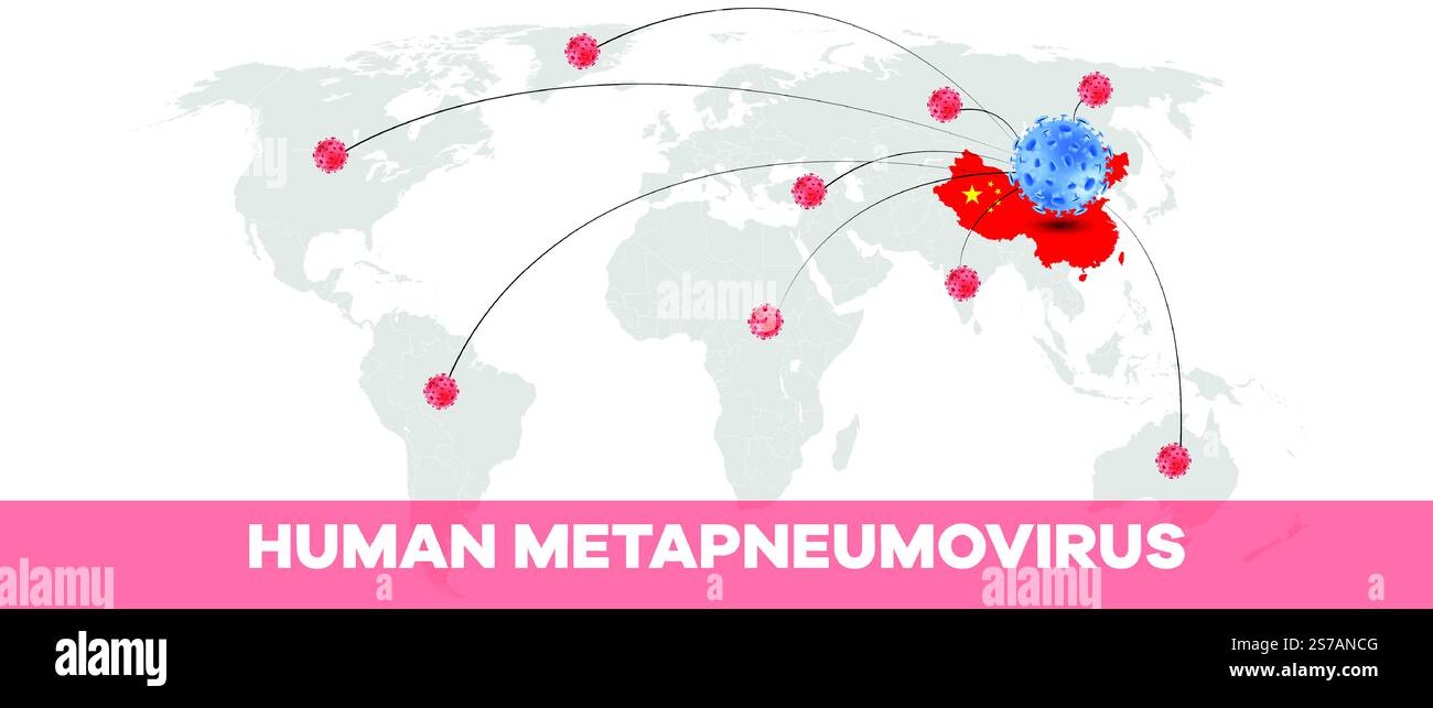 HMPV Virus Banner Template. Human Metapneumovirus Poster. hMPV Virus ...