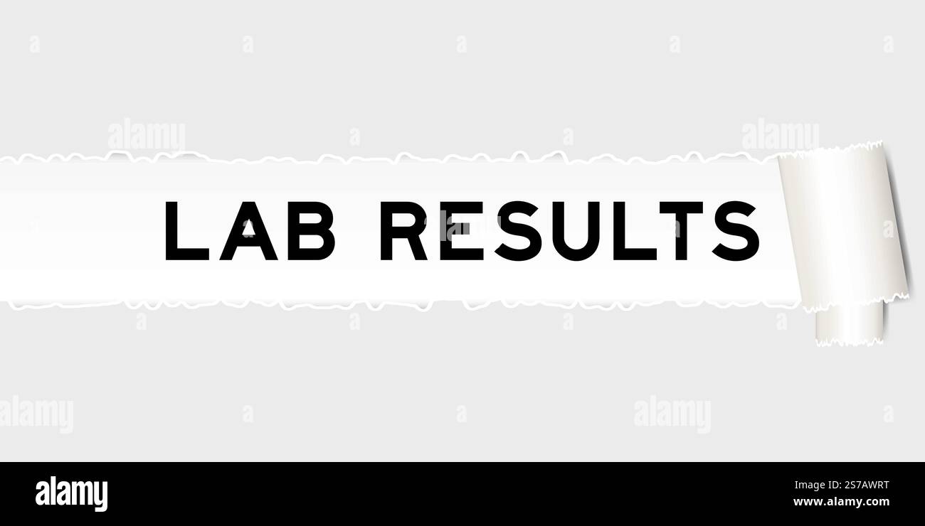 Ripped gray paper background that have word lab results under torn part Stock Vector Image & Art ...