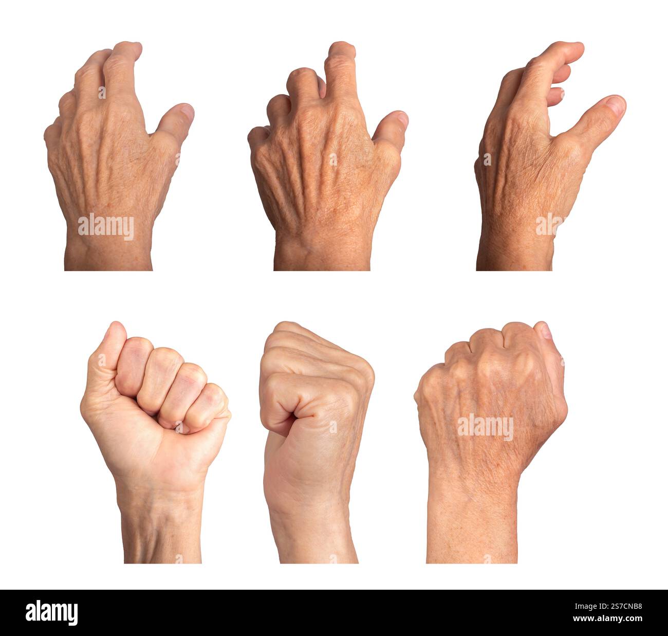 Elderly woman's hand outstretche, clenched fist transitioning to open ...