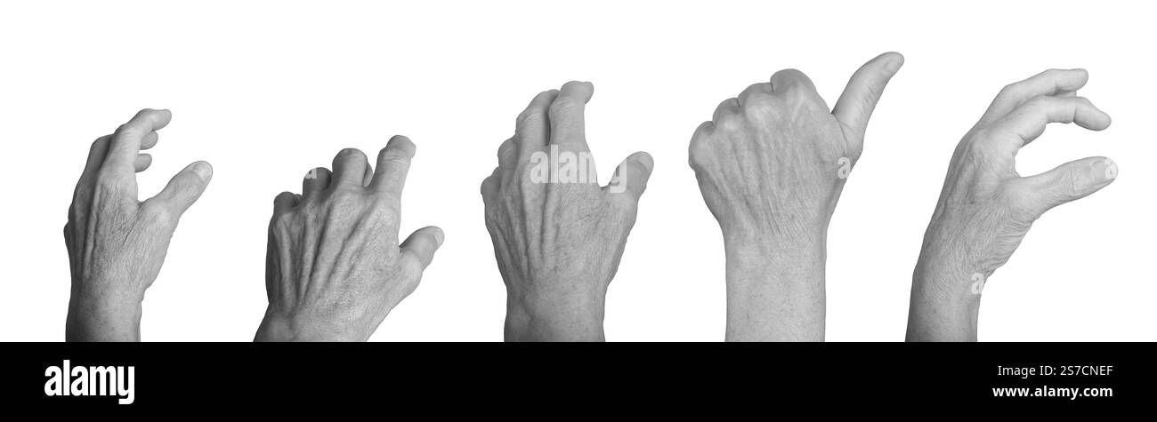 Elderly woman's hand in a grasping pose, thumb up and fingers curled as ...