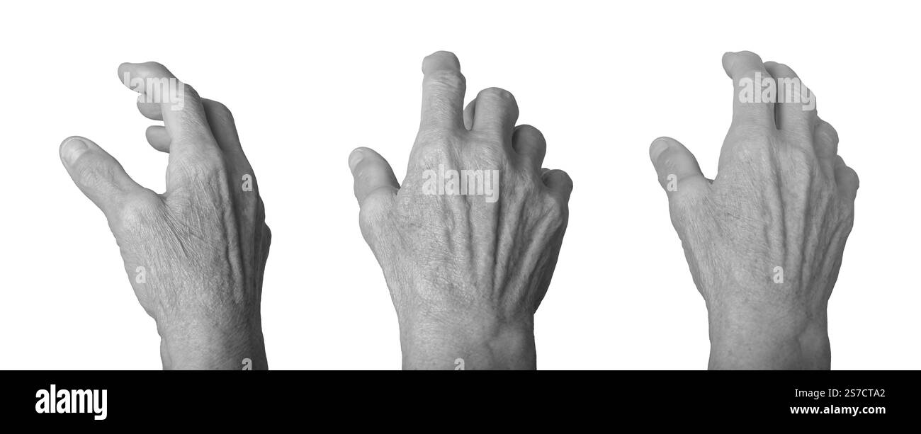Elderly female hand outstretched, pointing and reaching with wrinkled ...