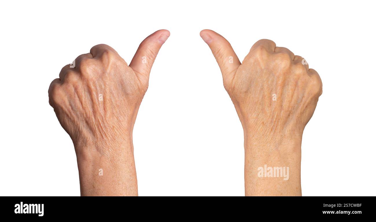 Elderly caucasian female hand showing thumb-up gesture, wrinkled skin ...