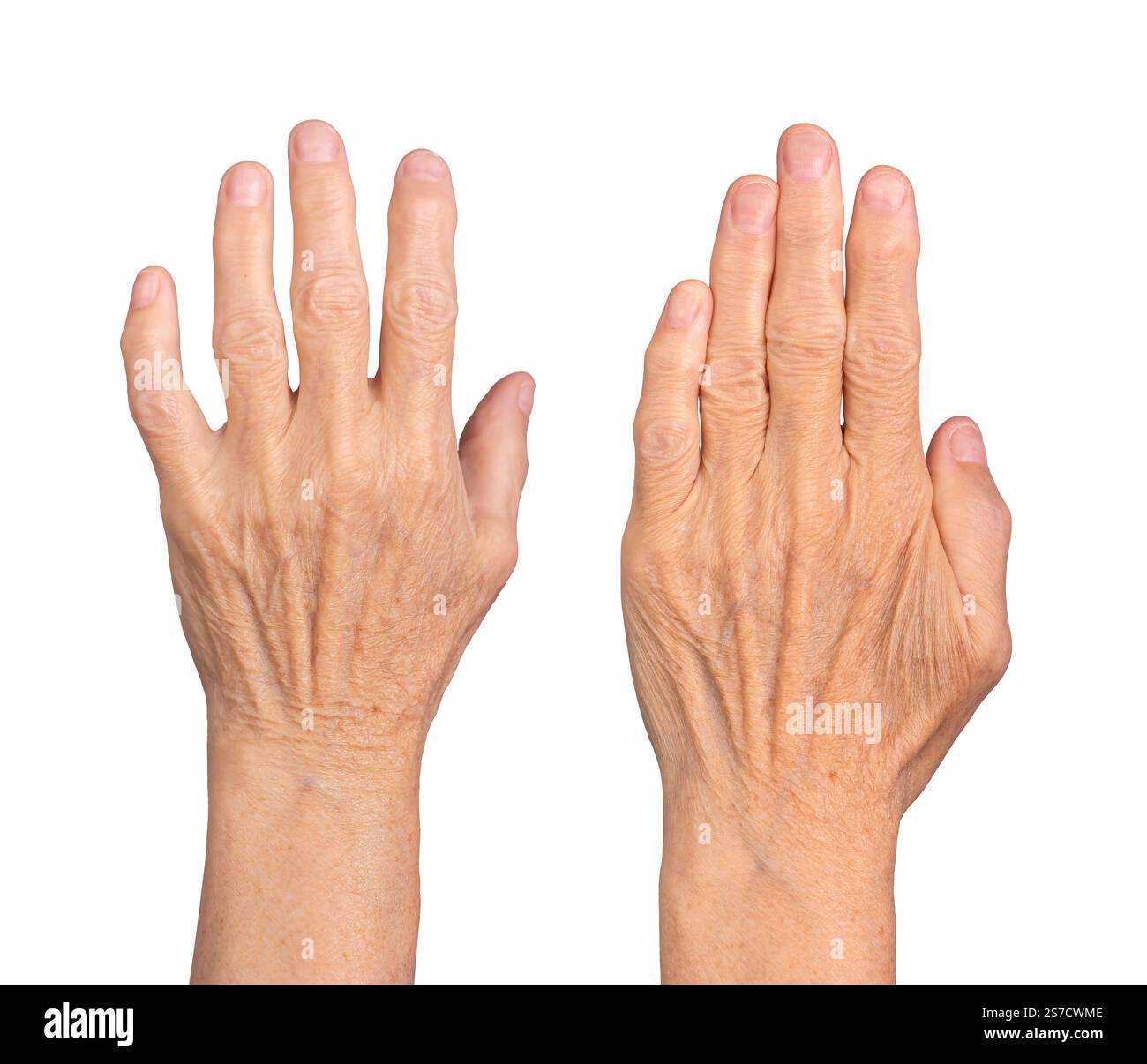 Closeup of elderly caucasian woman's hands, dorsal view with fingers ...