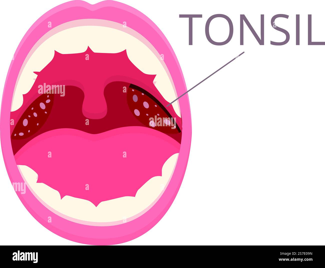 Mouth tonsillitis icon cartoon vector. Bacterial hygiene. Cancer ...