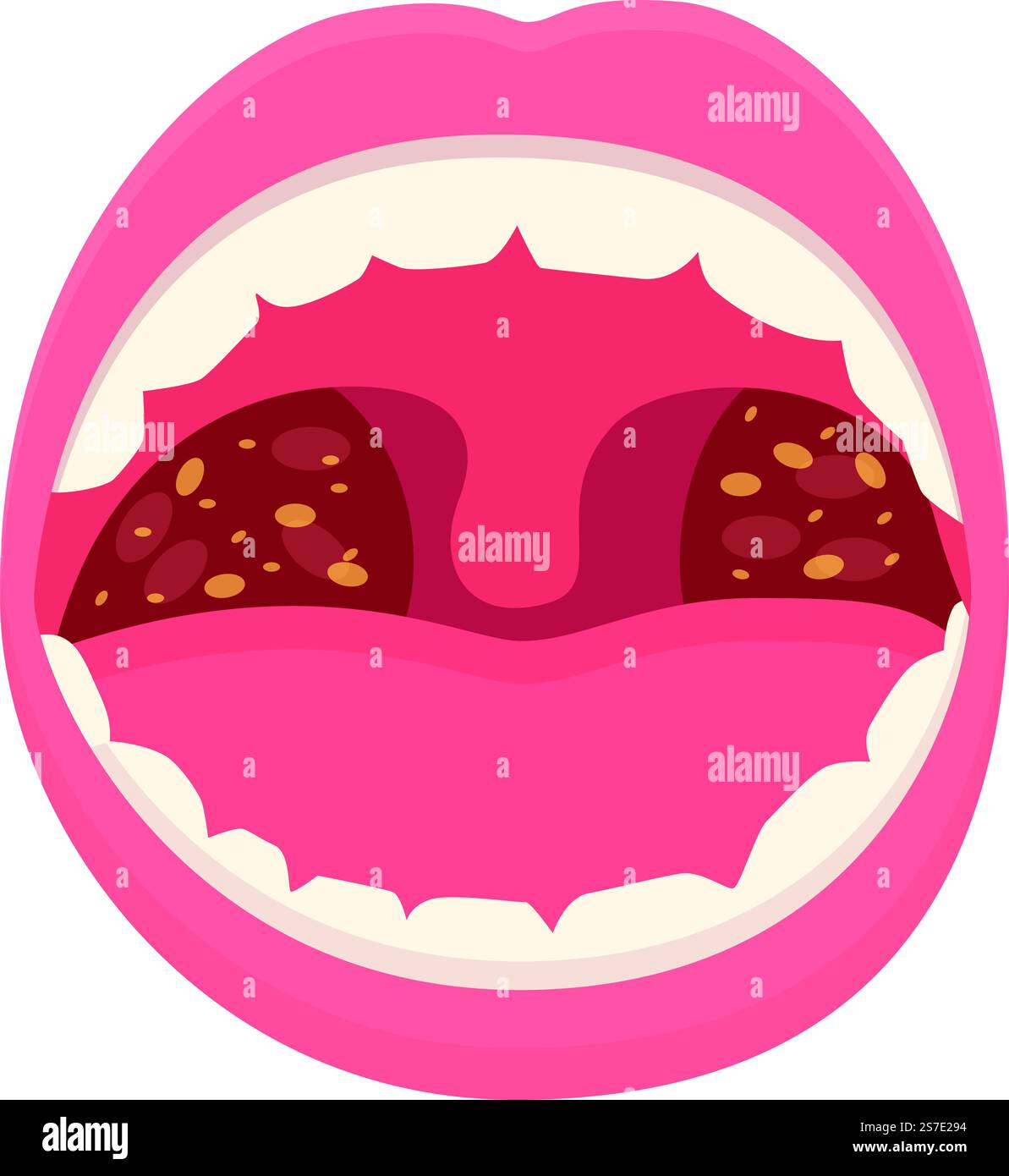 Medical pain mouth icon cartoon vector. Throat health. Dentist disease ...