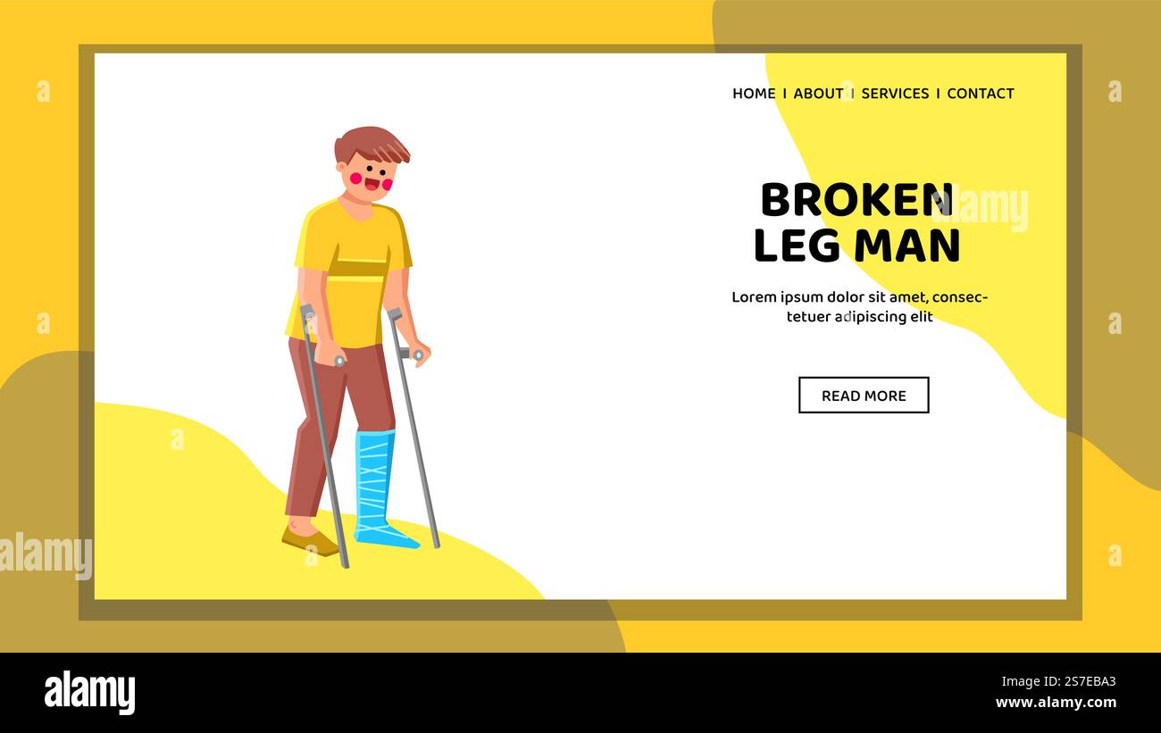 broken leg man vector. injury health, medical accident, home adult ...