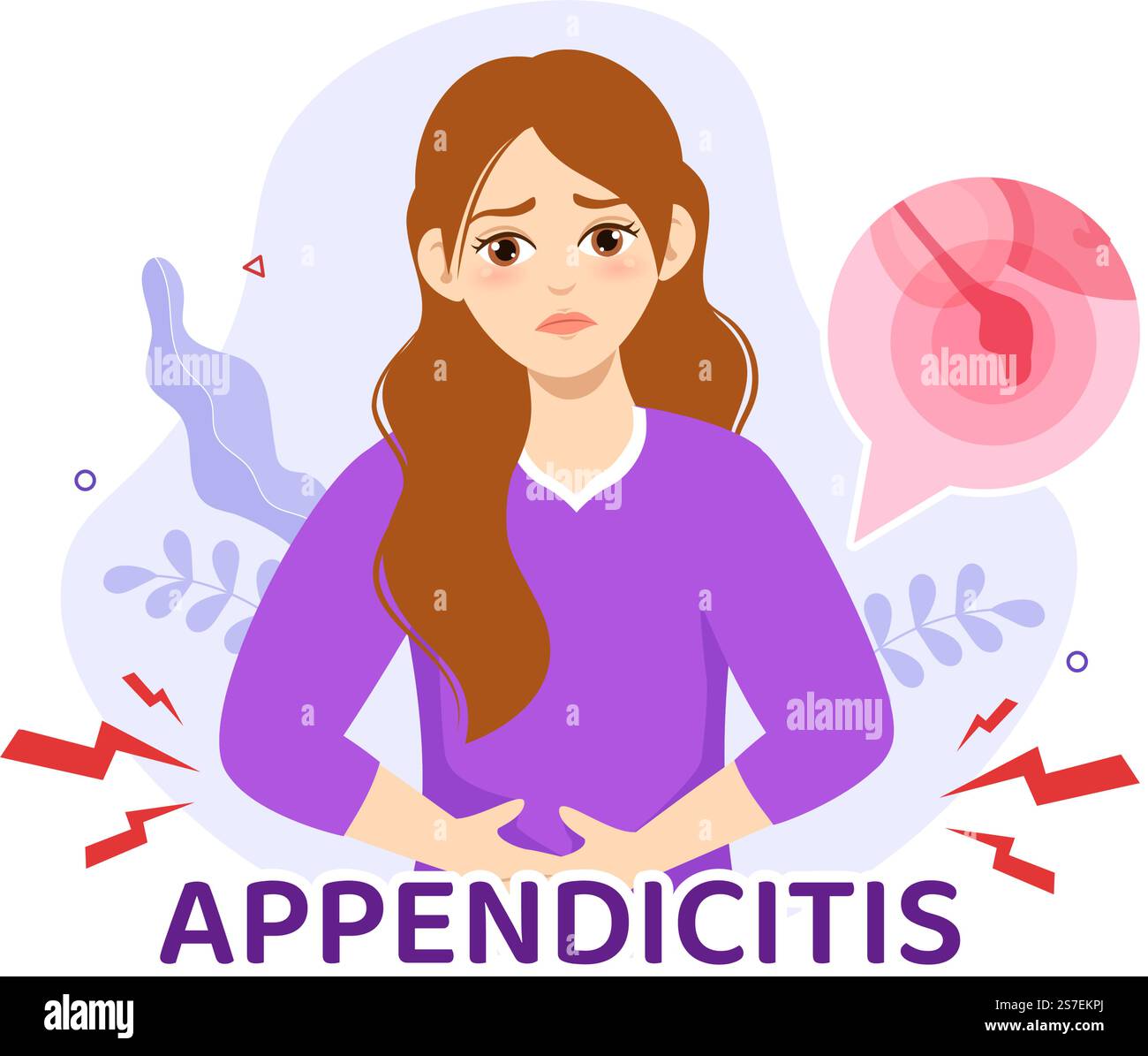 Appendicitis Illustration with Inflammation of the Appendix and Stomach ...