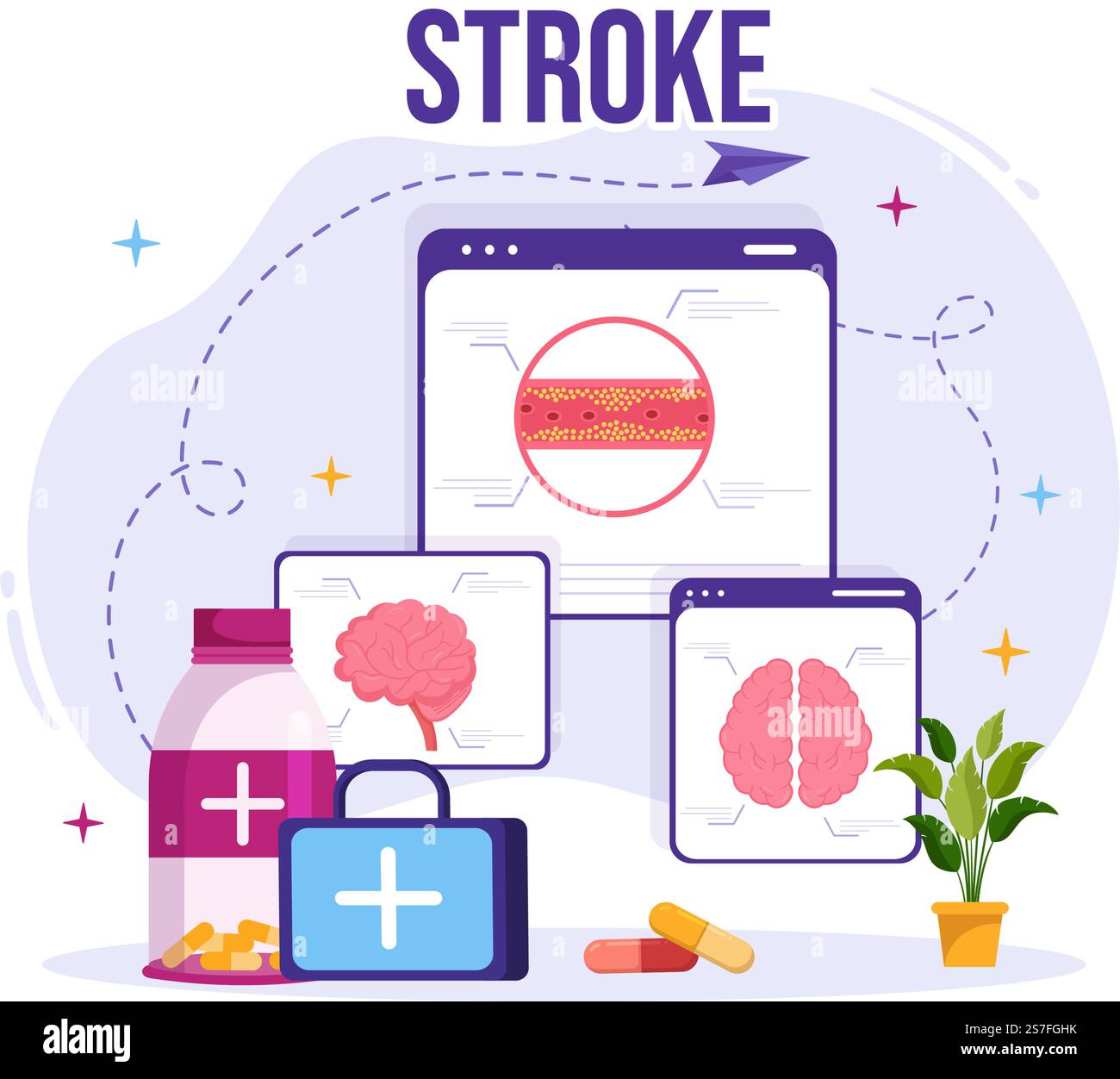 Human Brain Stroke Vector Illustration with Scientific Medical ...