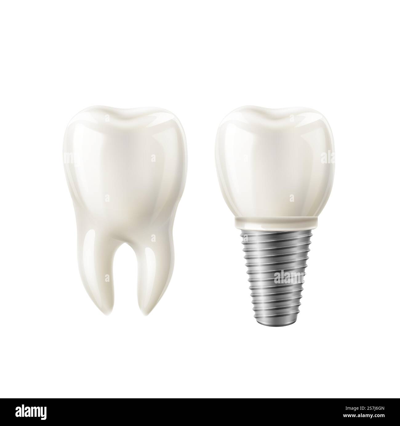 Vector realistic white tooth and dental implant mockup set. Clean tooth ...