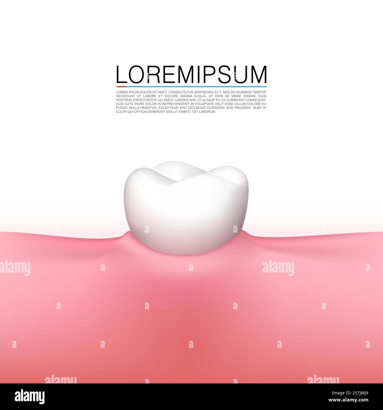 Tooth in the jaw, cover on white background. Vector illustration Stock ...