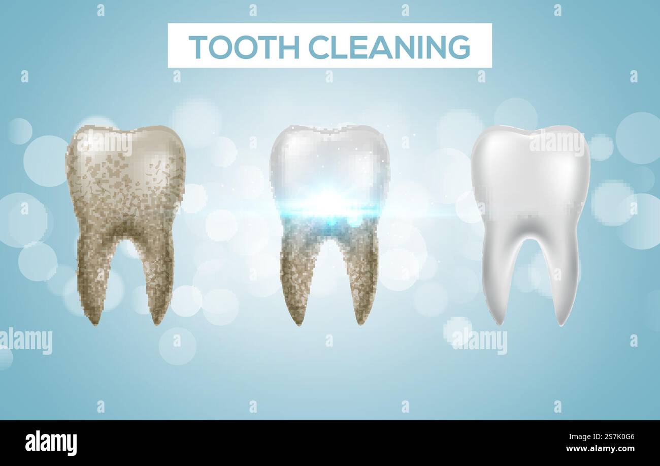 Tooth clean 3d health. Dental realistic dirty whitening. Dentist teeth ...