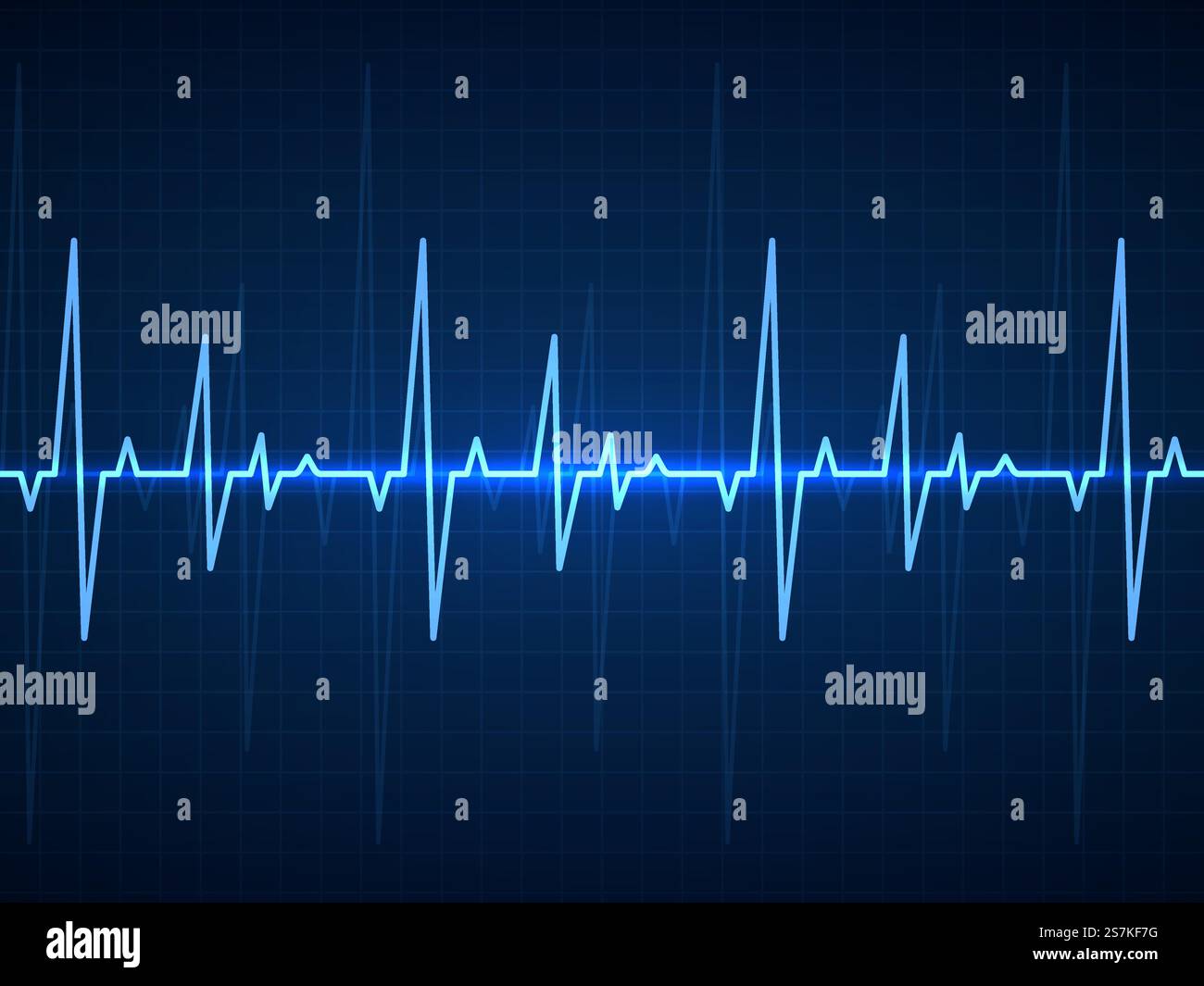 Ekg. Blue sinusoidal pulse lines, monitor with heartbeat signal ...