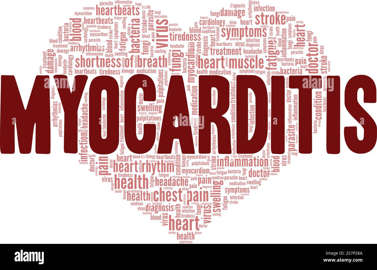 Myocarditis - inflammation of the heart muscle conceptual vector ...