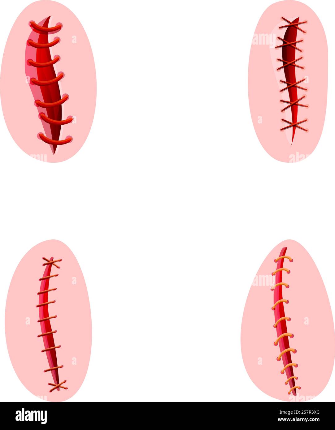 Surgical suture icons set cartoon vector. Various type of operating ...
