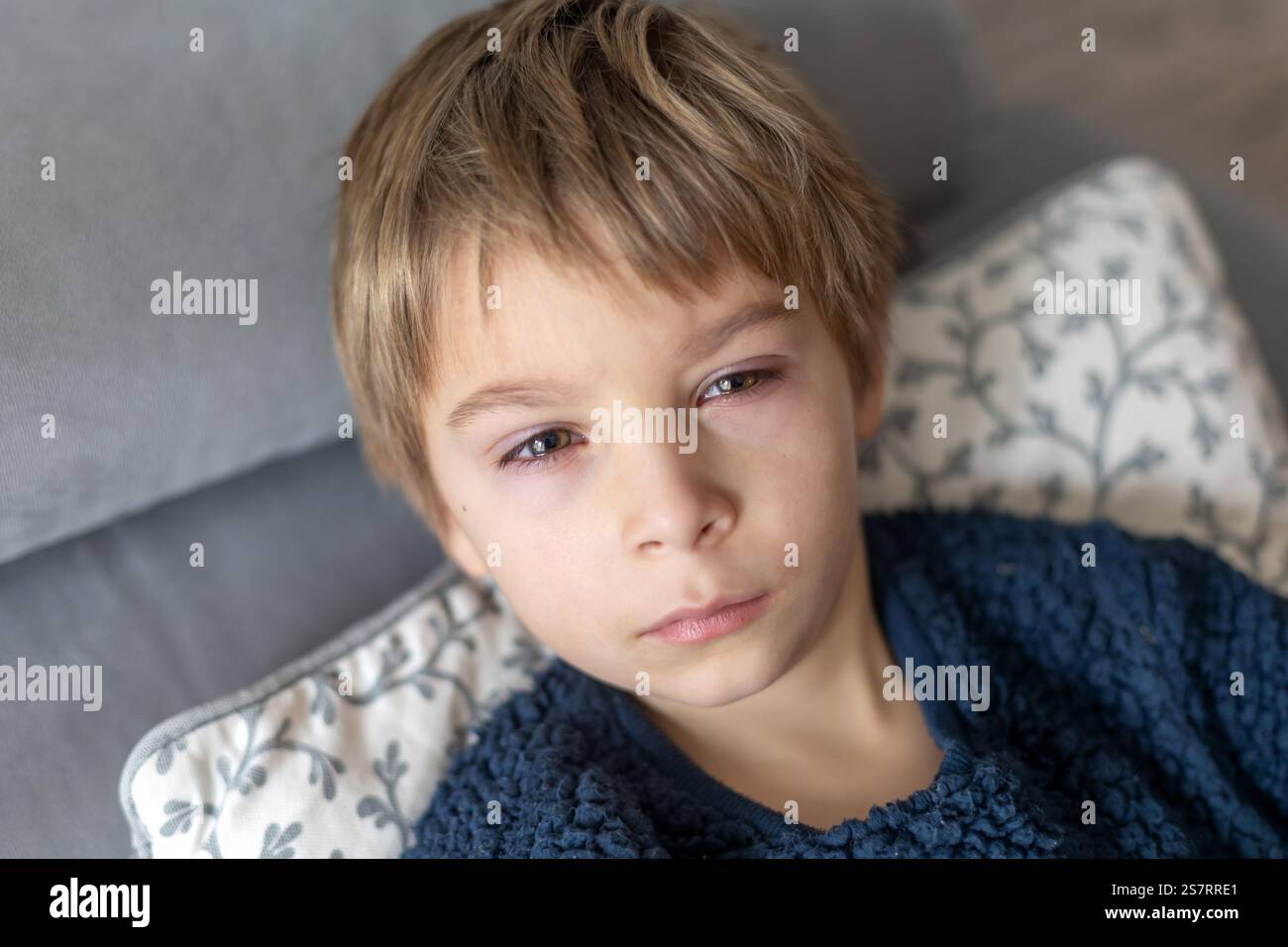 Blond child, boy with eye allergy and conjunctivitis red allergic ...