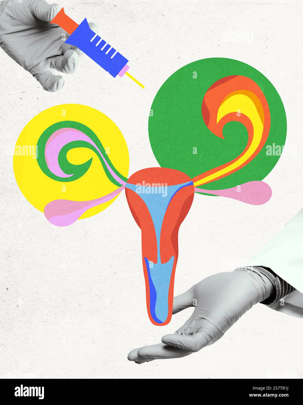 Abstract representation of female reproductive organs with syringe and ...