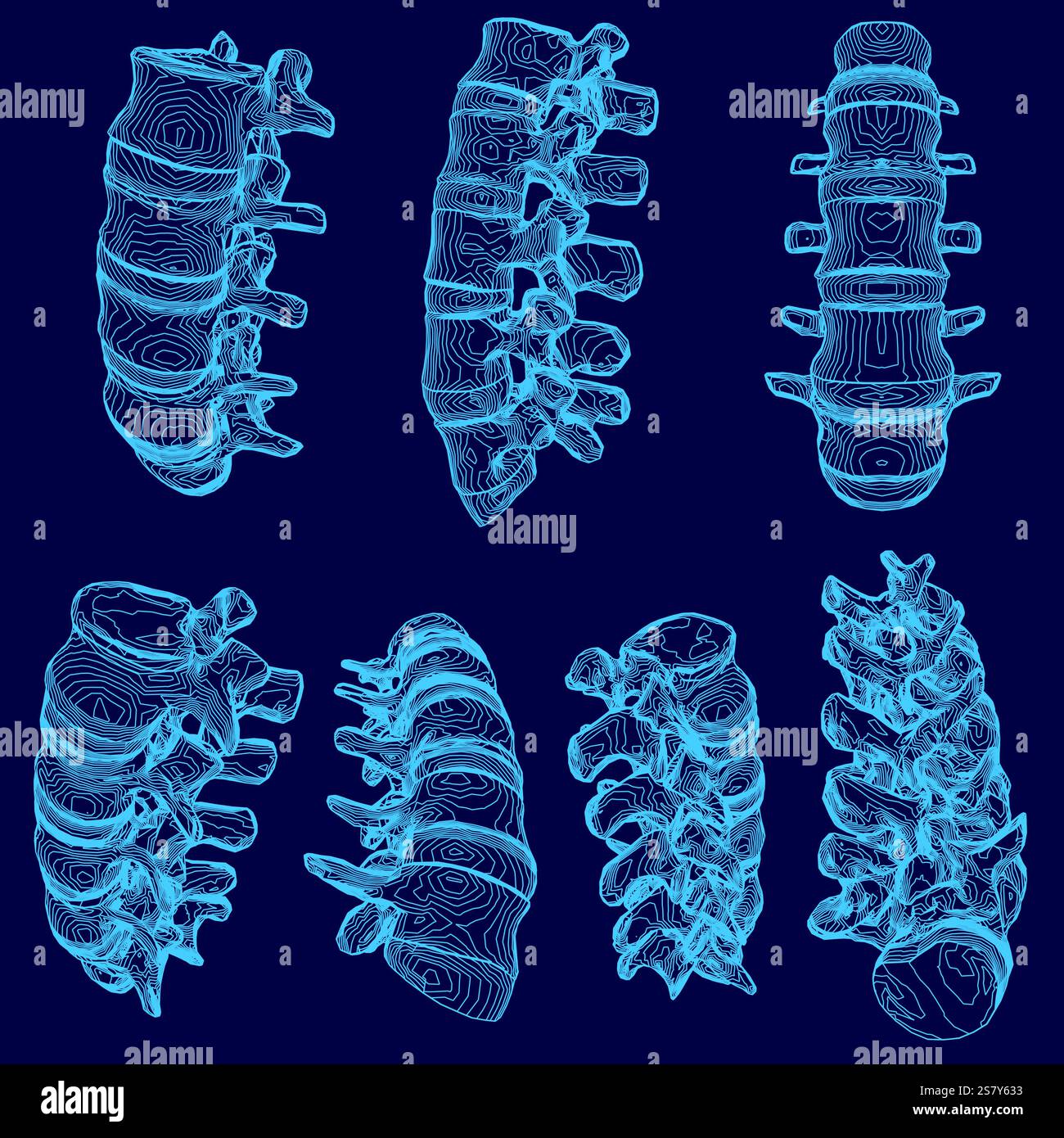 The image is a series of blue drawings of the spine, with each drawing ...