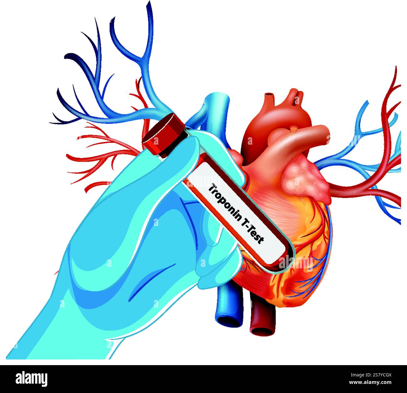 Illustration of a troponin test for heart analysis Stock Vector Image ...