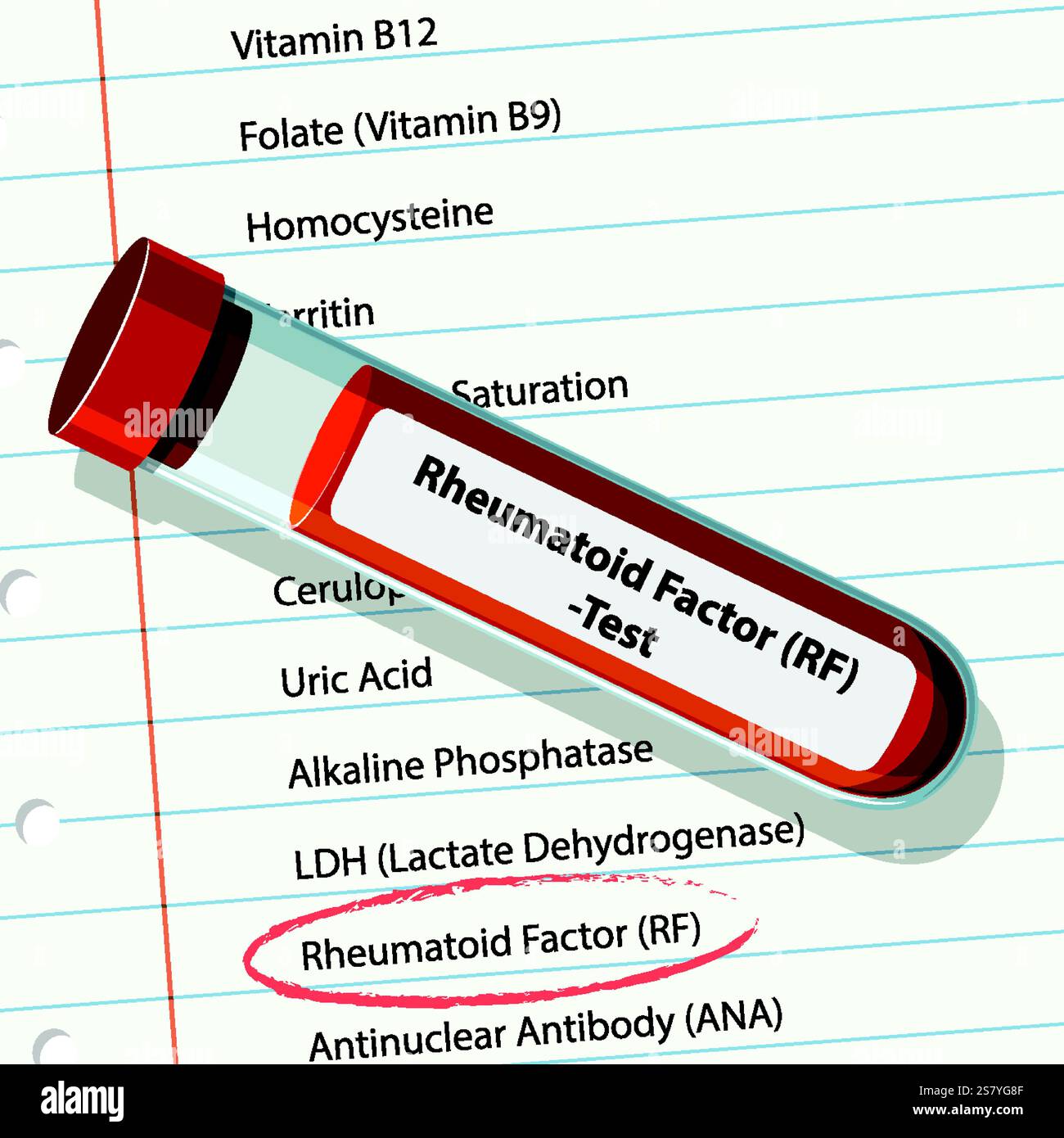 Illustration of a blood test for rheumatoid factor Stock Vector Image ...