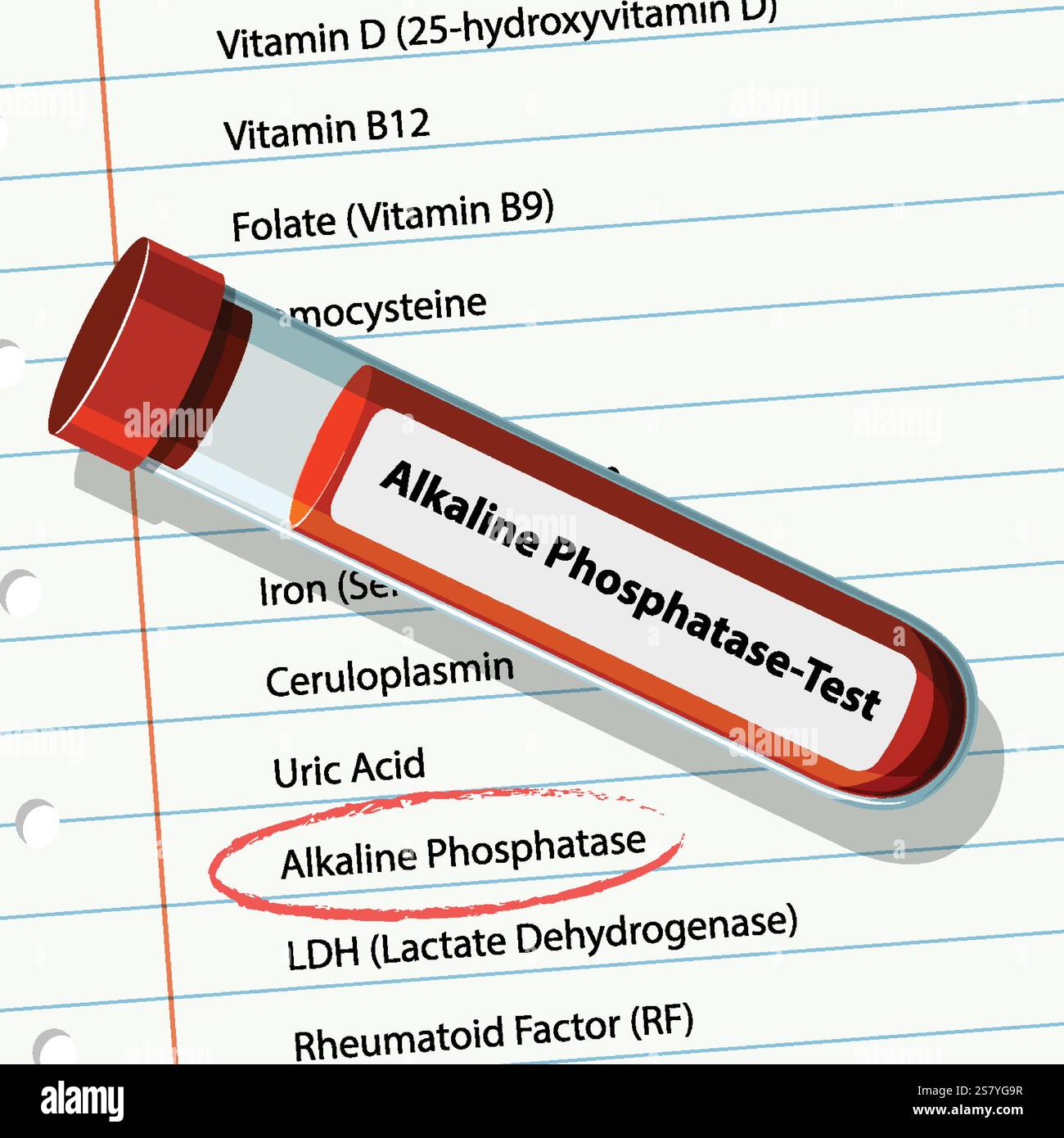 Illustration of a blood test for alkaline phosphatase Stock Vector ...