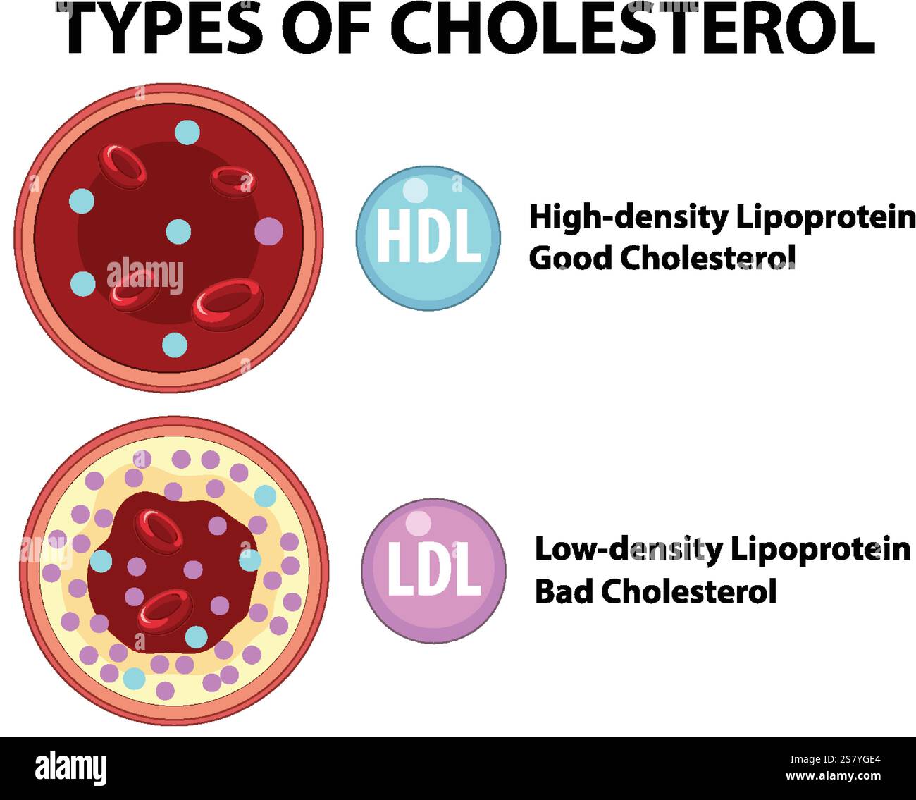 Illustration of HDL and LDL cholesterol types Stock Vector Image & Art - Alamy