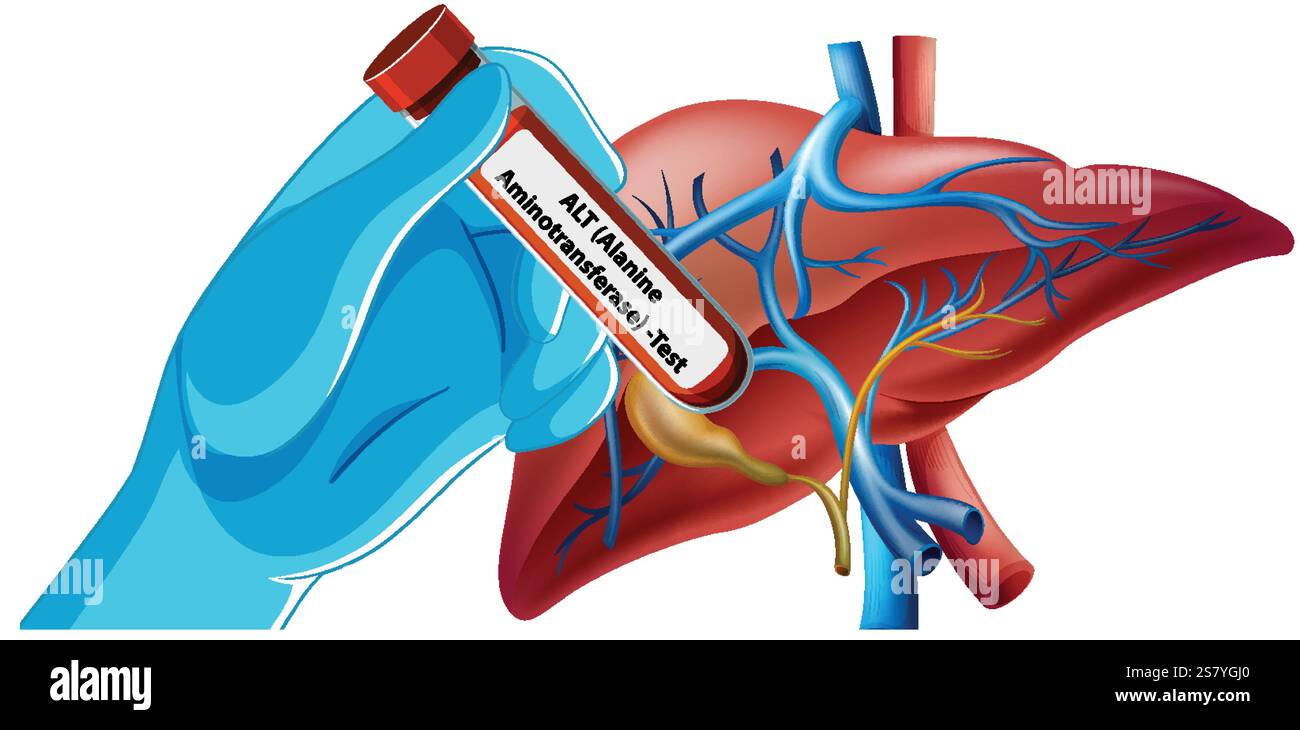 Illustration of ALT blood test and liver anatomy Stock Vector Image ...