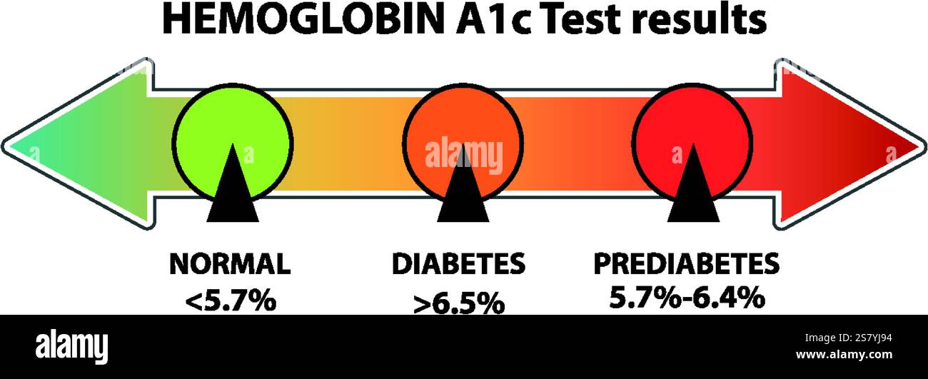 Visual representation of results hi-res stock photography and images ...